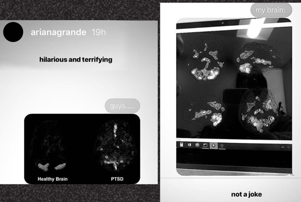Ariana Grande’s PTSD Brain Scan – Follow Me Here…